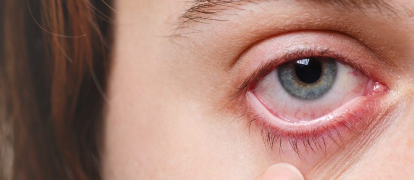 Toxoplasmose: o que é e qual são os tratamentos? - 6 sintomas ...