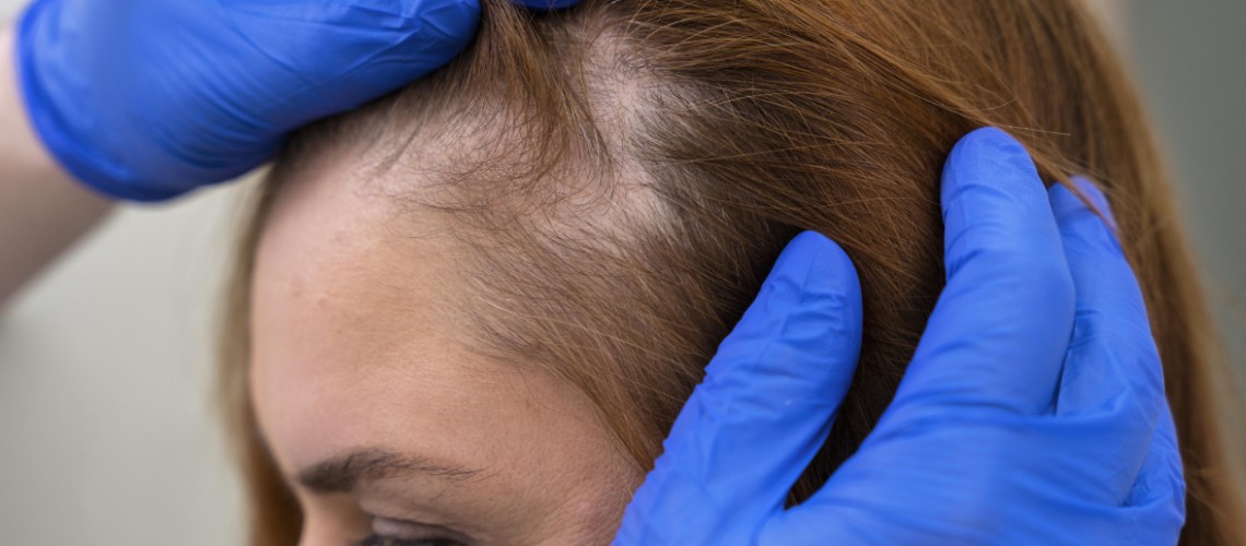 Ferida Na Cabeça O Que Pode Ser E Como Tratar Unicallmed Worldwide